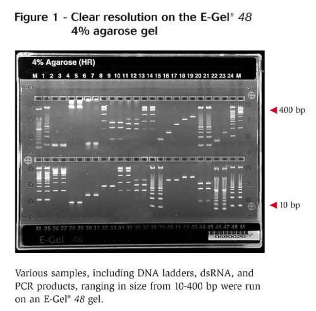 Agarose Gel Resolution Selling Discounts | www.oceanproperty.co.th