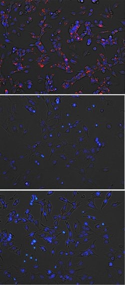 Low Density Lipoprotein from Human Plasma, pHrodo™ Green- and Red-LDL ...