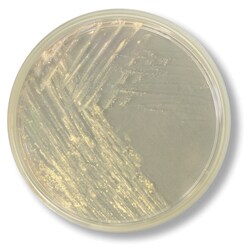 Mitchison 7H11 Selective Agar with Carbenicillin, Polymyxin B ...