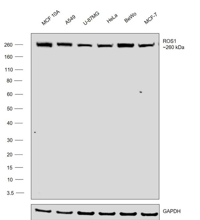ROS1 Antibody (MA5-26760)