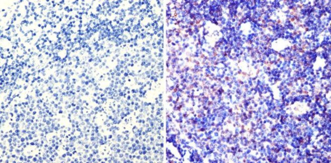 PAX5 Antibody (PA1-109)