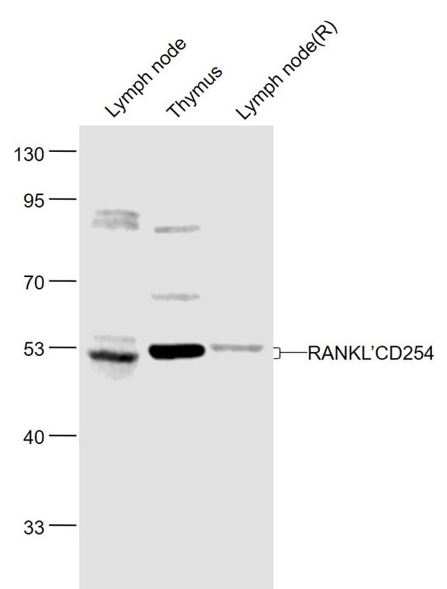 RANKL/CD254 Antibody (BS-20646R)