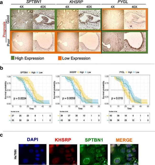 SPTBN1 Antibody (MA3-062)