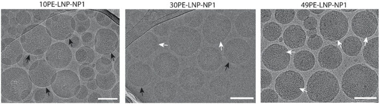 Lipid Nanoparticles - Cryo TEM - LNPs - Drug Delivery