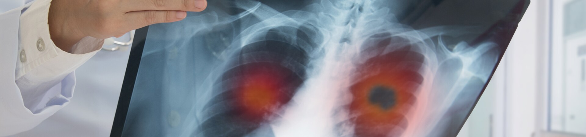 Lung Analysis Micro Optical Sectioning Tomography Life In Atomic Resolution