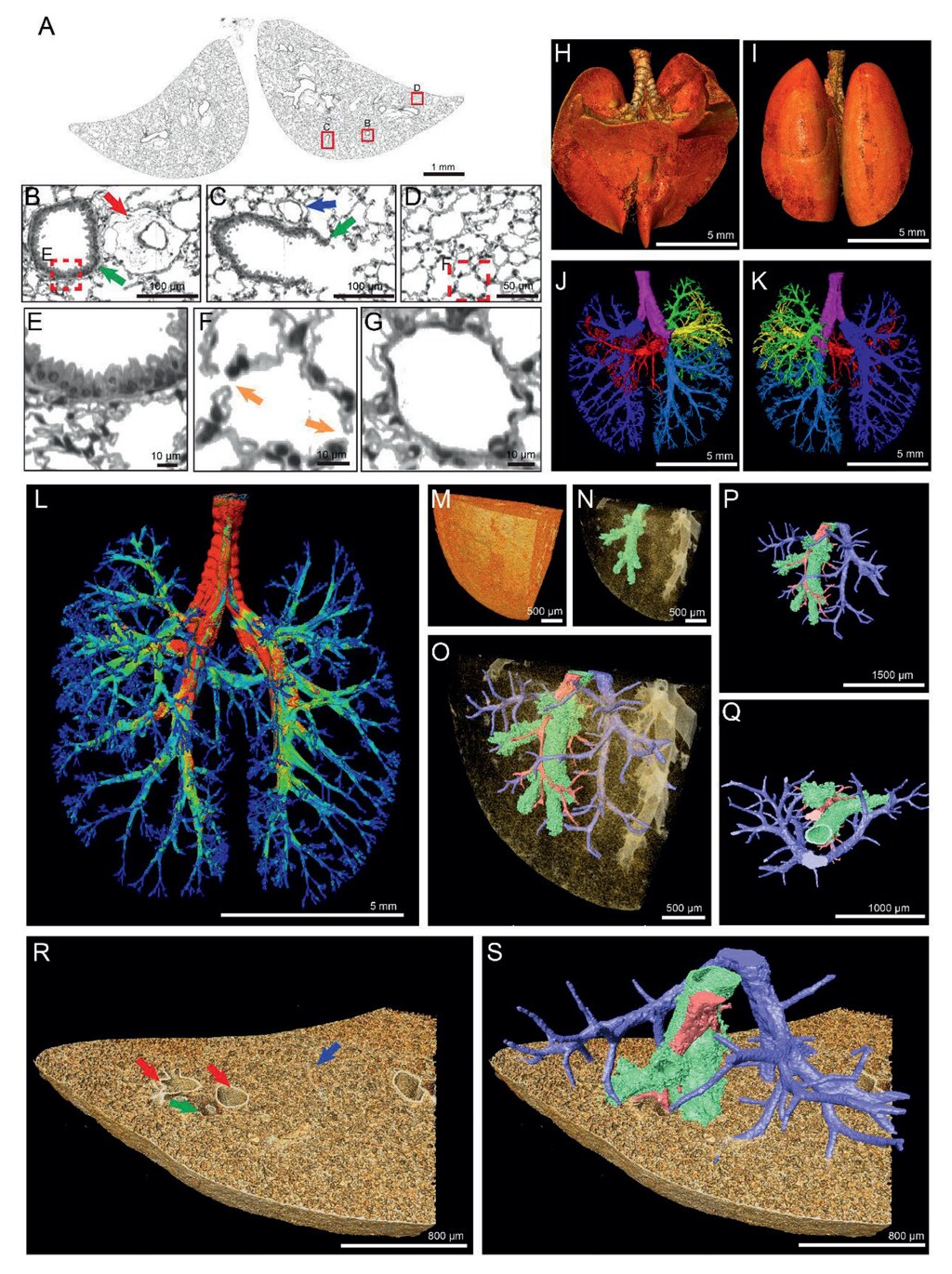 Lung Analysis Micro Optical Sectioning Tomography Life In Atomic