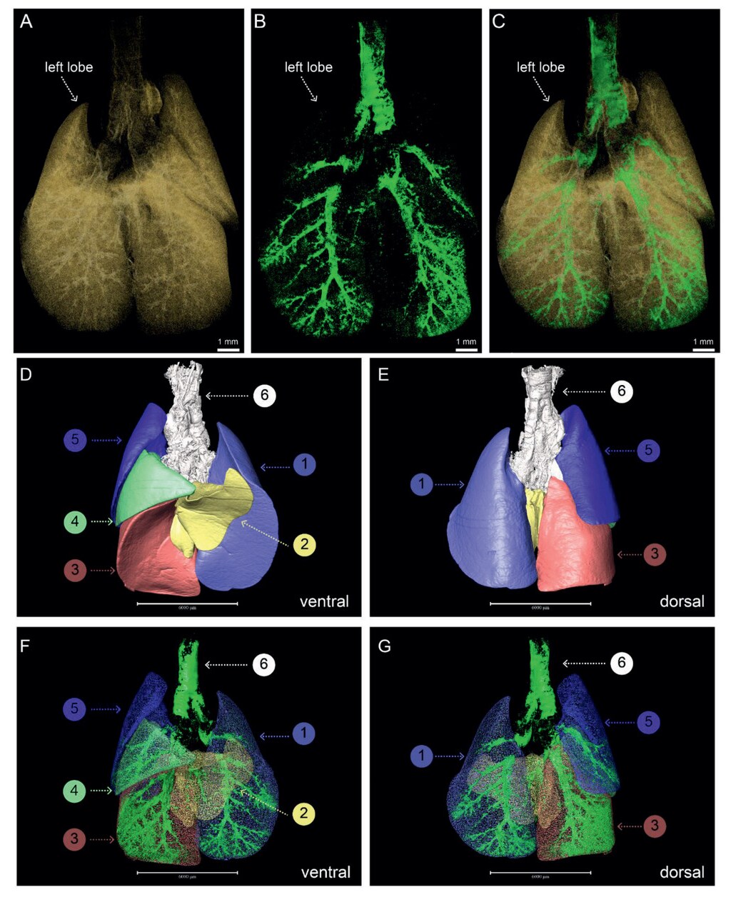 Lung Analysis Micro Optical Sectioning Tomography Life In Atomic Resolution