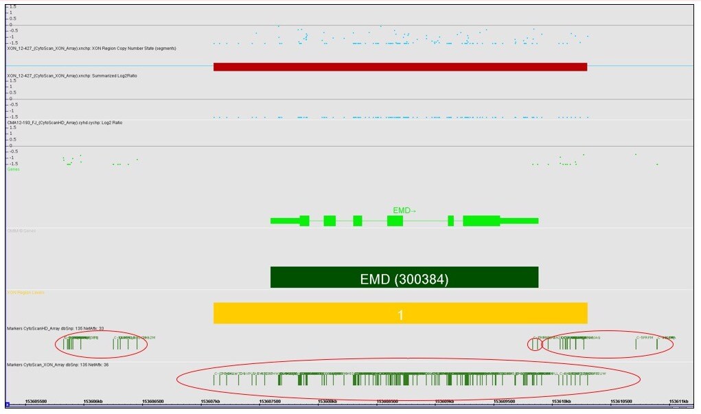 Improved Understanding of Fetal Abnormalities with CytoScan XON and ...