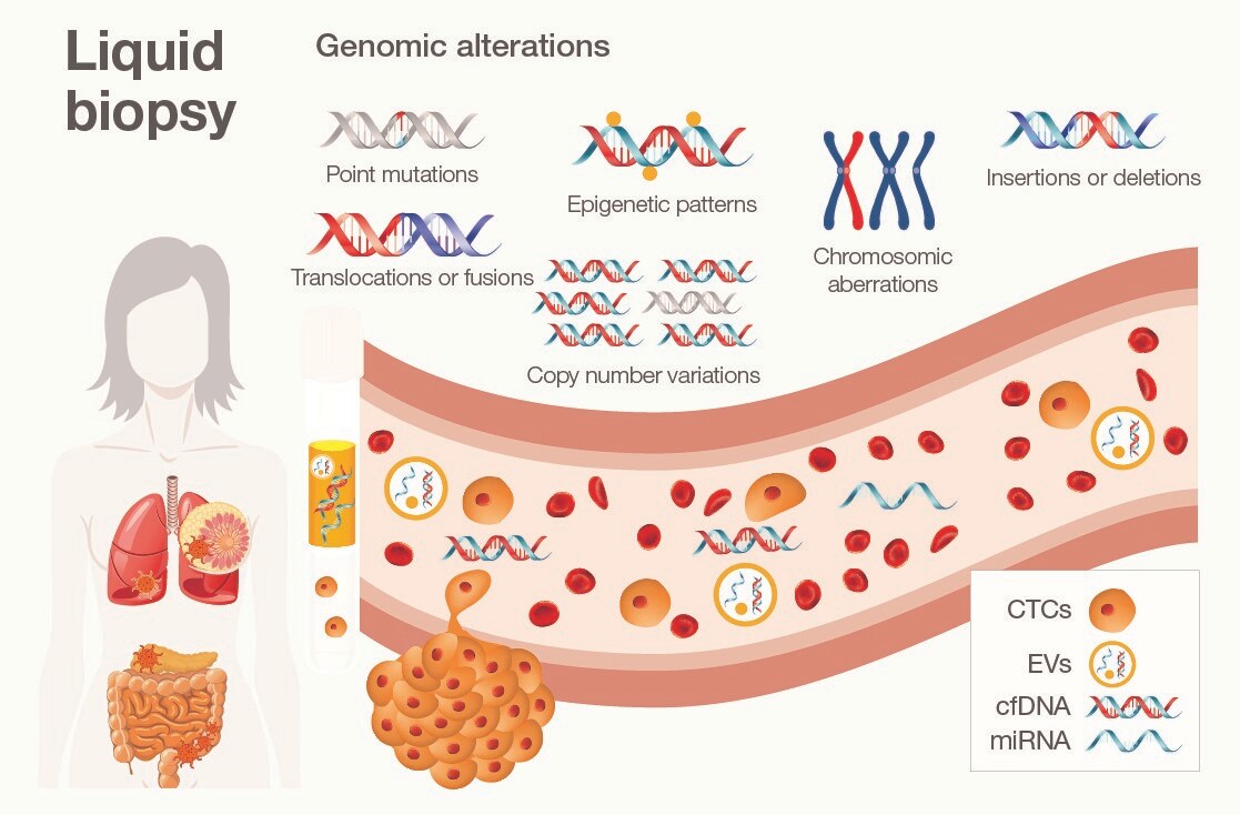 Cancer Heterogeneity and Liquid Biopsy - Precision Medicine