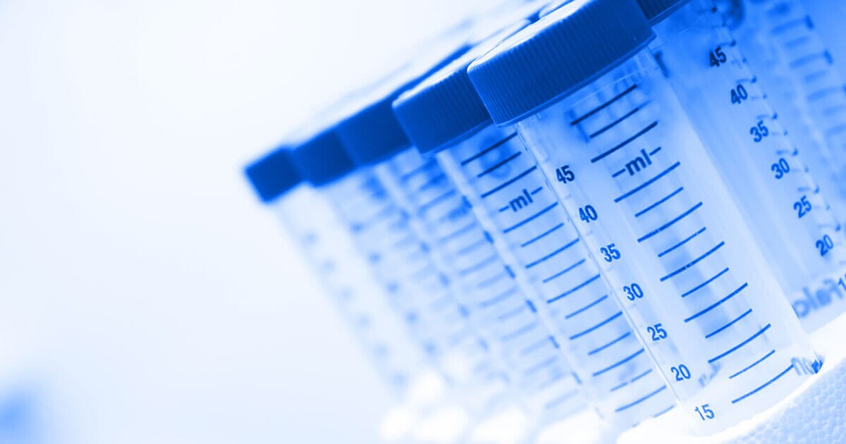 共免疫沈降法の「問題点」と「改善策」まとめ｜知っておきたい！タンパク質実験あれこれ 第9回 - Learning at the Bench