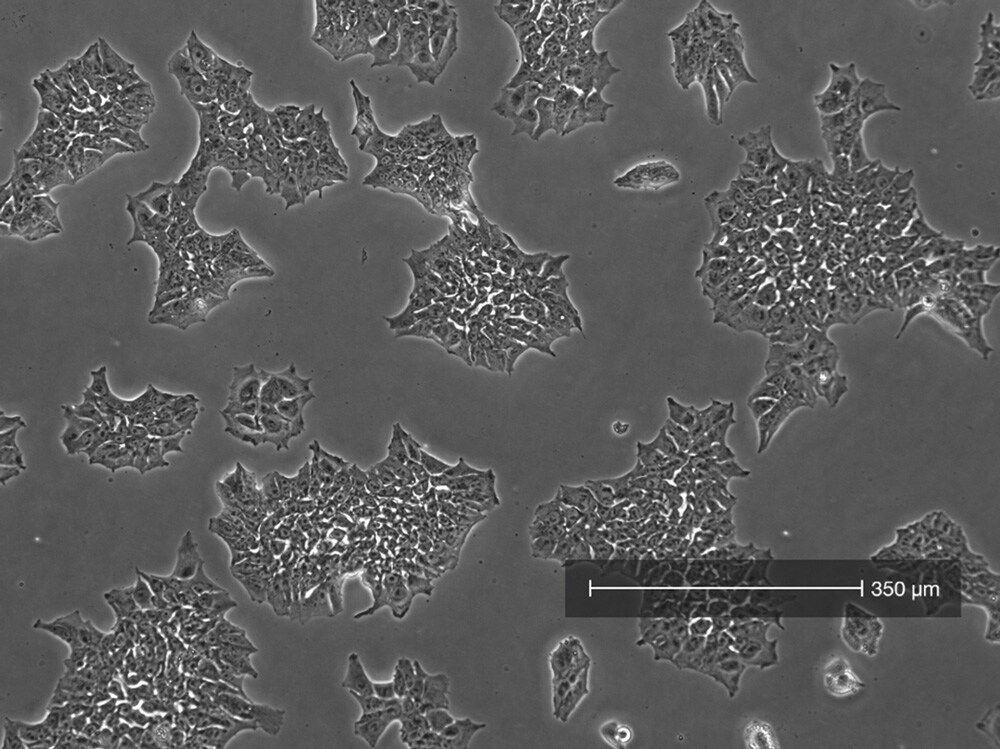 How to Measure Cell Confluency - Life in the Lab