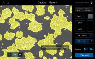 How to Measure Cell Confluency - Life in the Lab