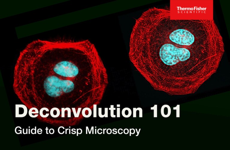 Image Deconvolution 101: Guide to Crisp Microscopy
